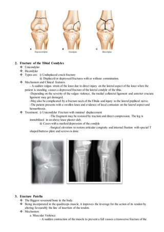 Injuries of the Knee - Rivin | DOCX