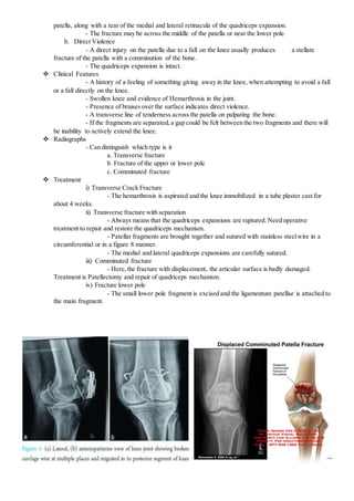 Injuries of the Knee - Rivin | DOCX