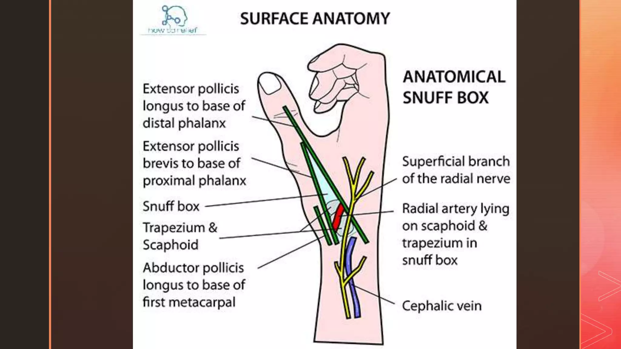 Injuries of the Upper limb.pptx | Death, Injury, or Military Conflict ...