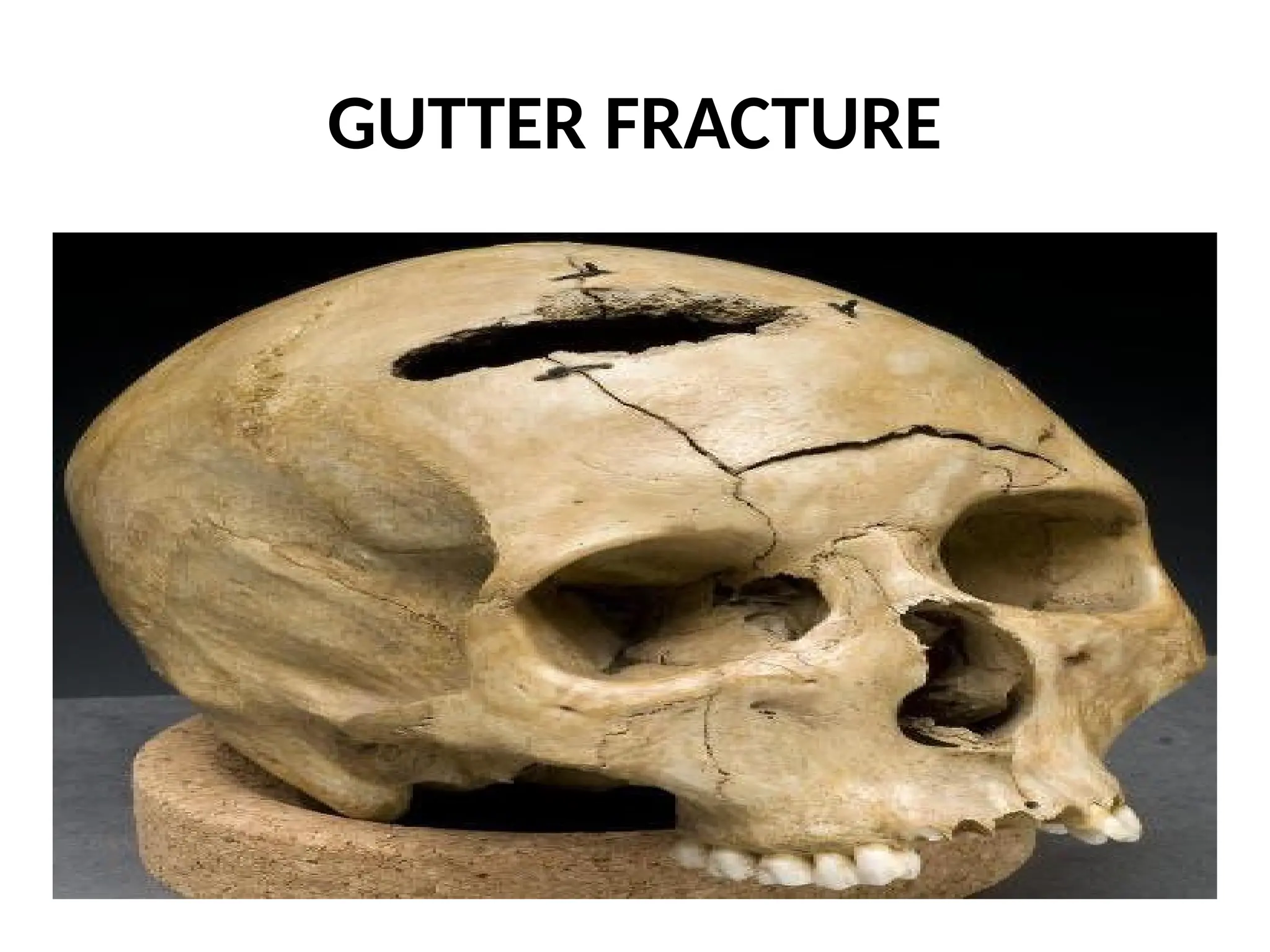 injuries photos. in forensic medicinepptx | PPT