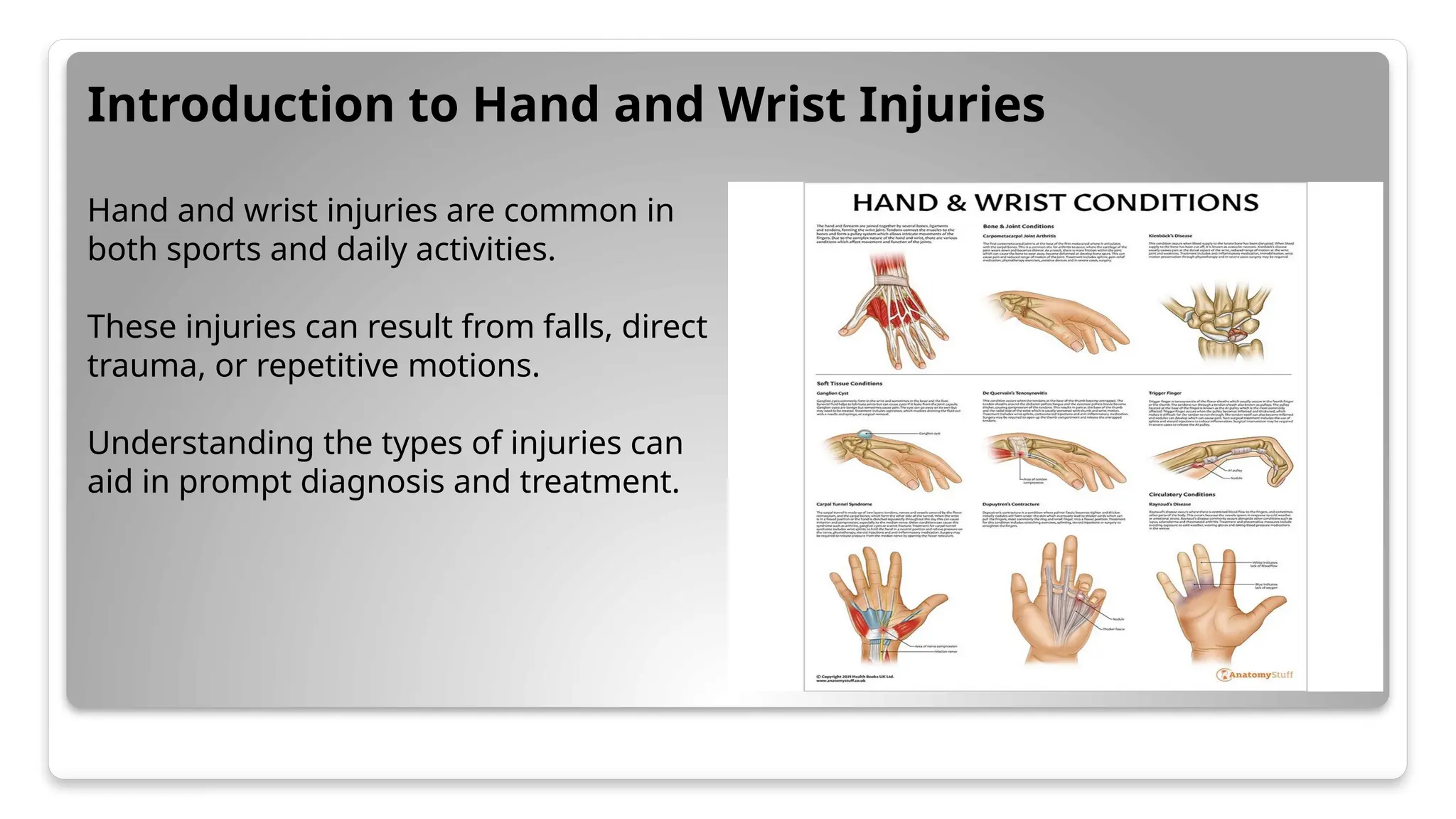 Injuries To Hand And Wrist (AMNA ).pptx.. | PPTX
