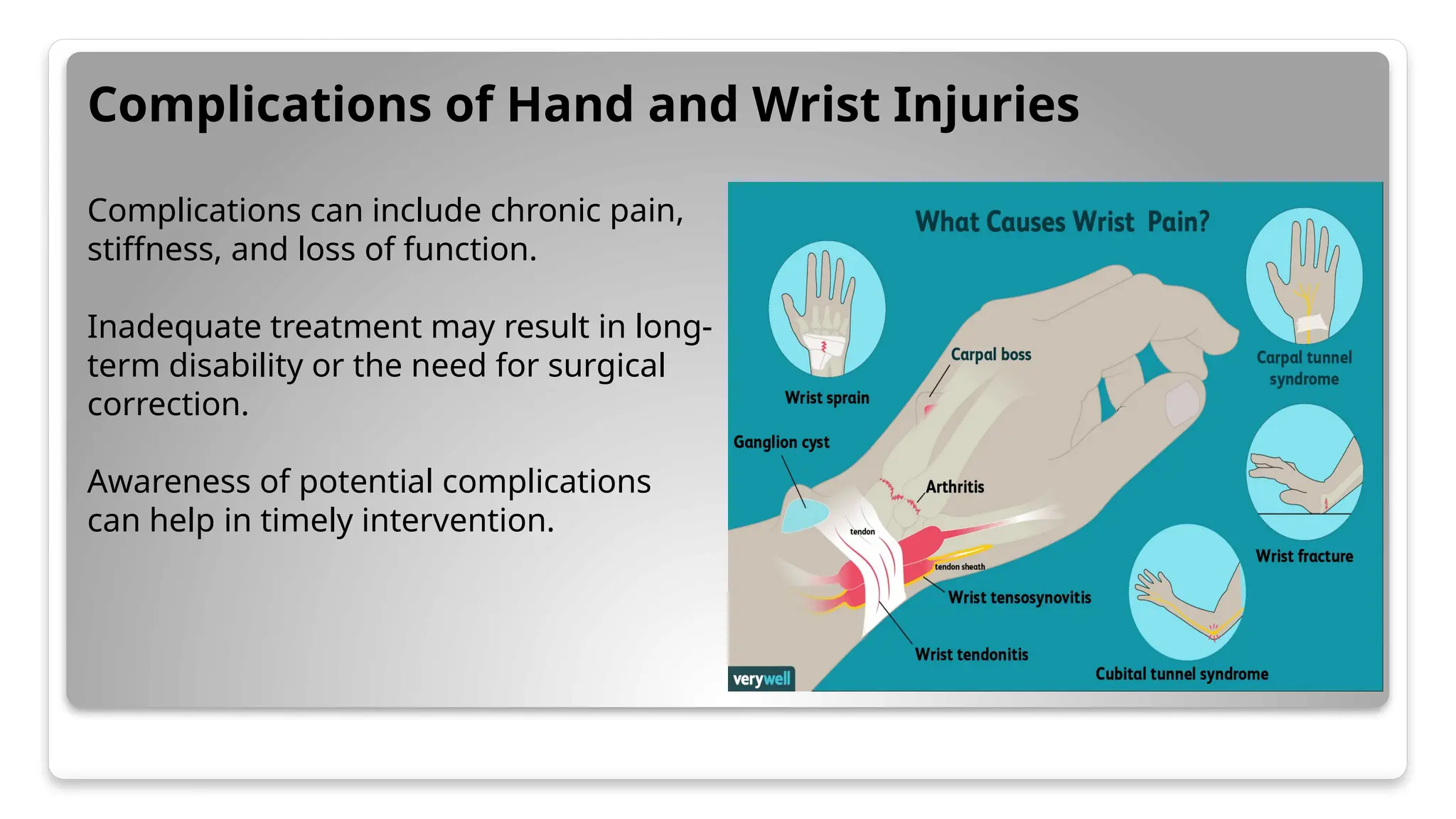 Injuries To Hand And Wrist of human body.pptx