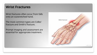 Injuries To Hand And Wrist of human body.pptx