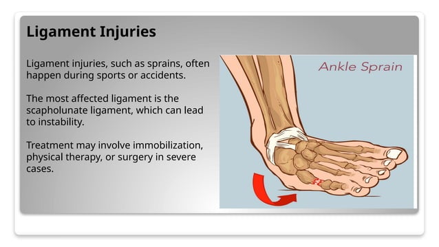 Injuries To Hand And Wrist of human body.pptx