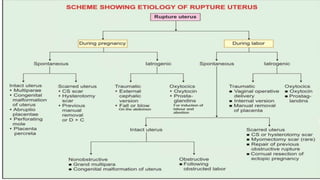 RUPTURE OF UTERUS | PPTX