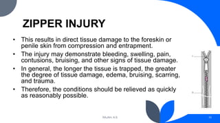 INJURIES TO THE MALE AND FEMALE GENITALIA.pptx | Sexual Conditions ...