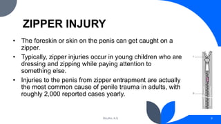 INJURIES TO THE MALE AND FEMALE GENITALIA.pptx | Sexual Conditions ...