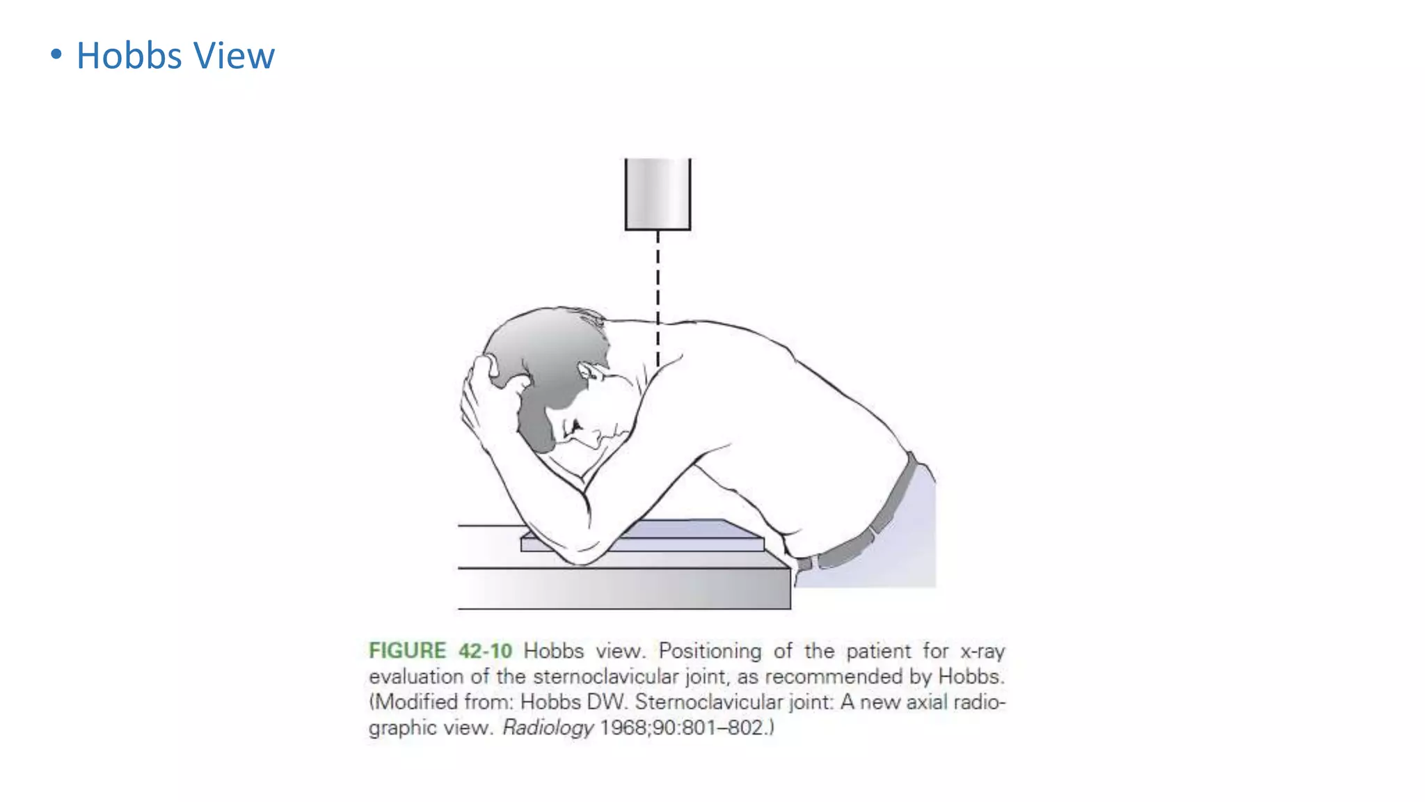 Injuries to the sternoclavicular joint | PPTX