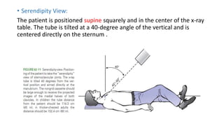 Injuries to the sternoclavicular joint | PPTX