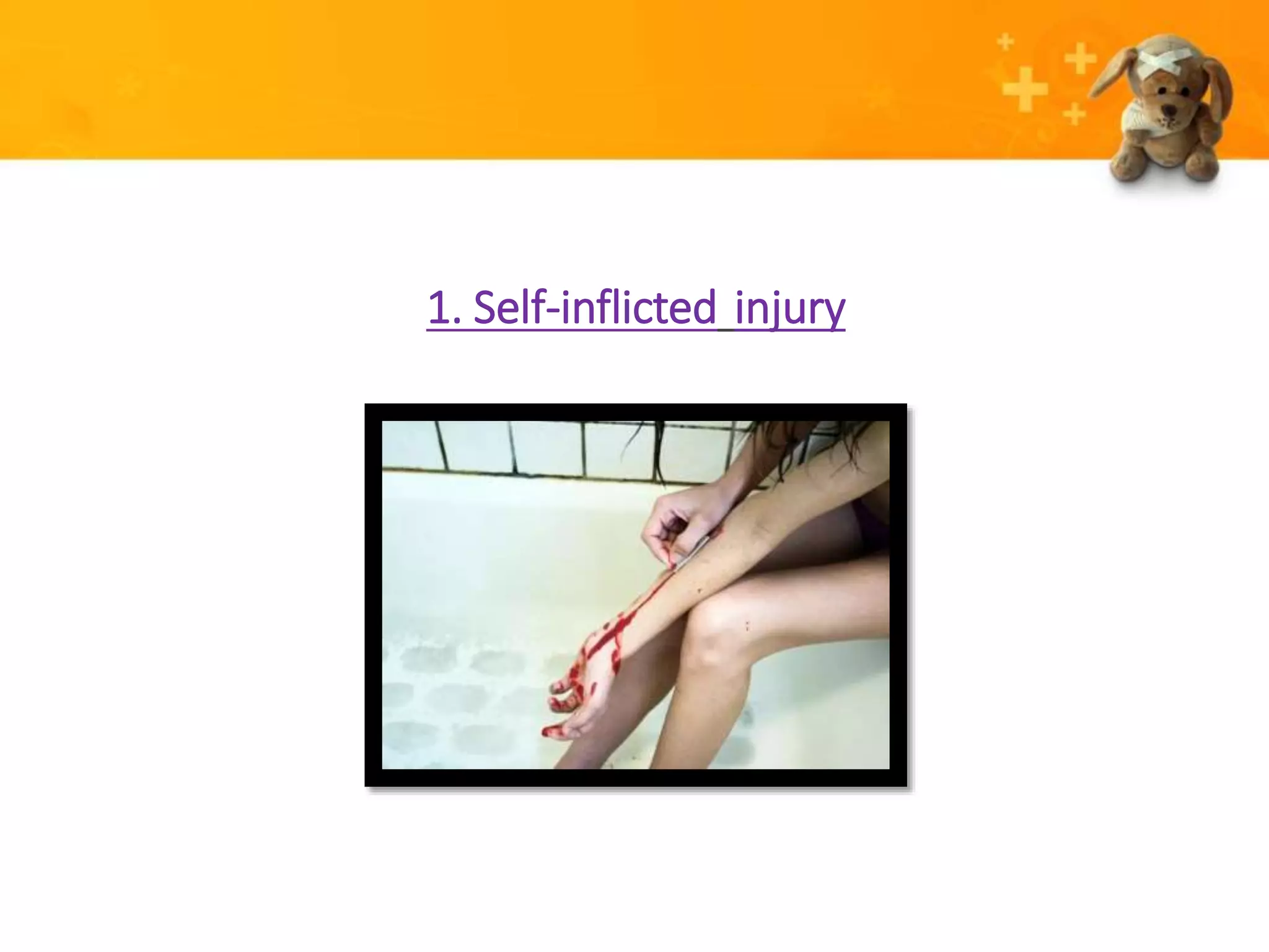 Injury (Forensic science) | PPTX