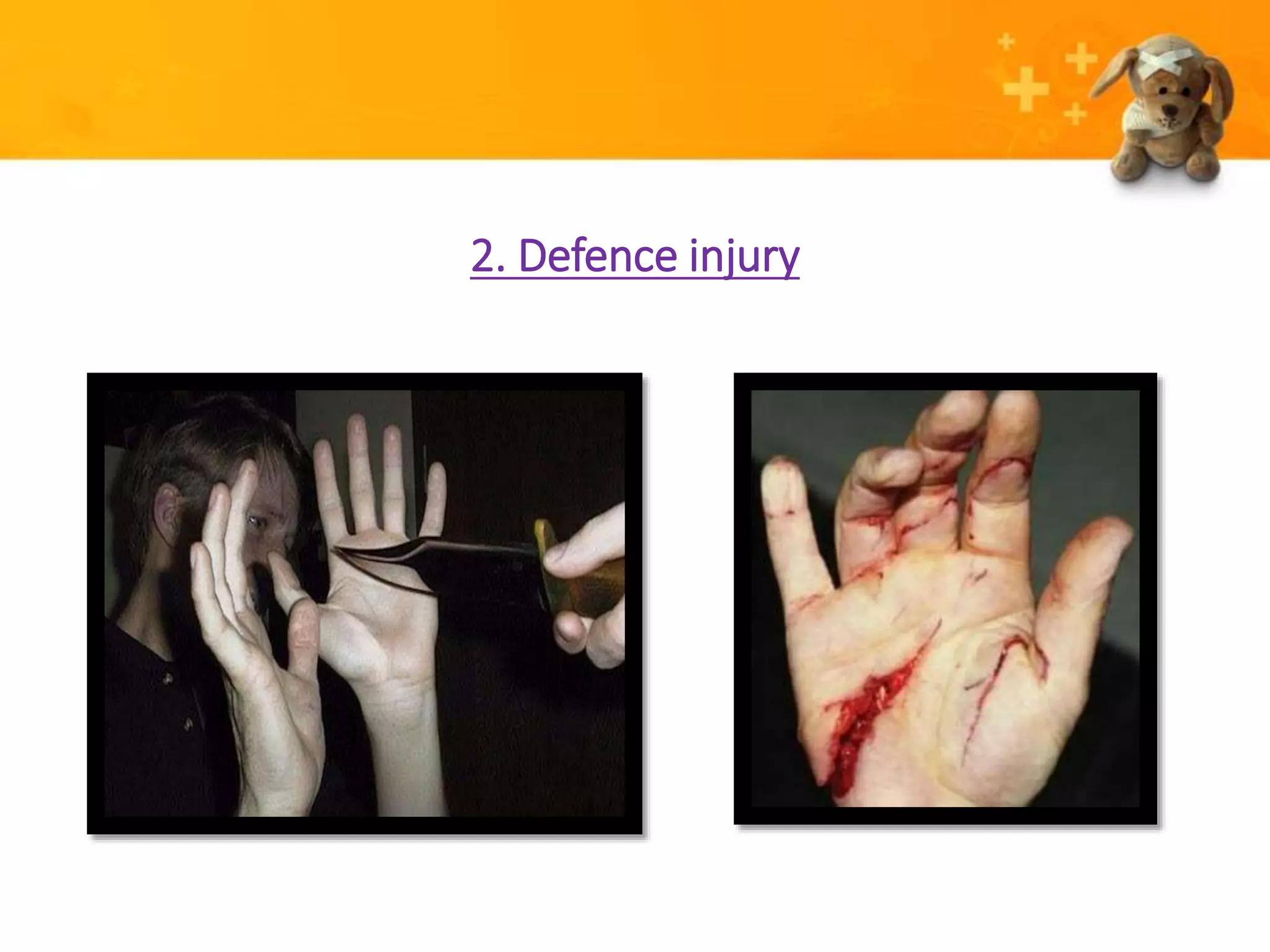 Injury (Forensic science) | PPTX