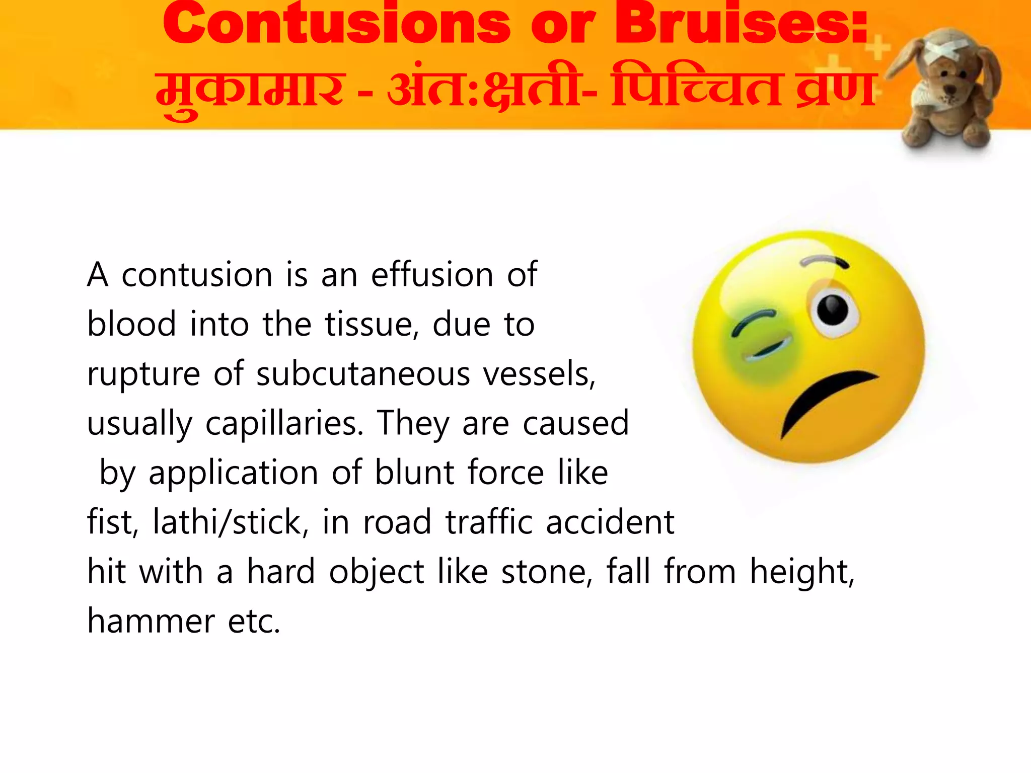 Injury (Forensic science) | PPTX