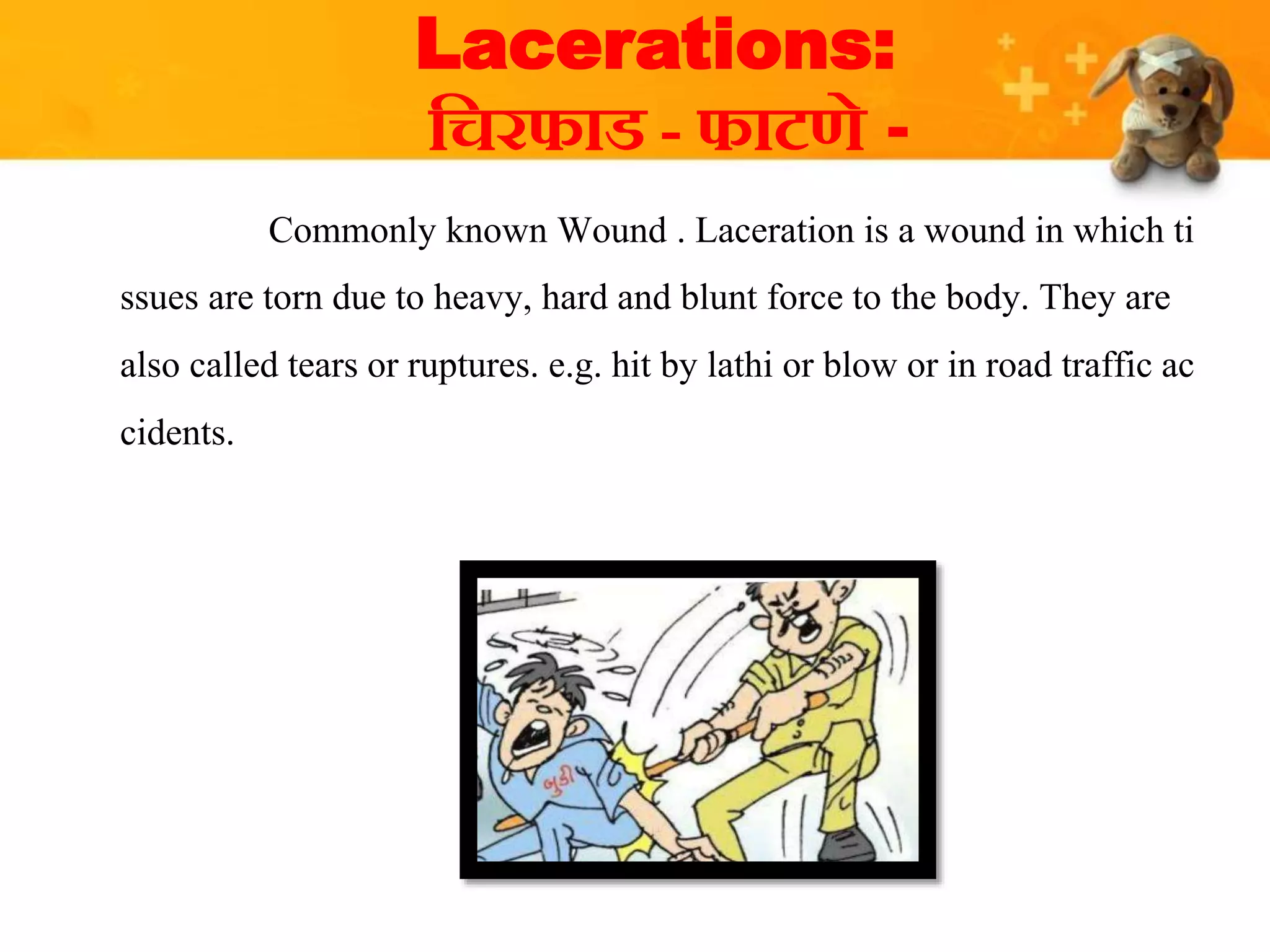 Injury (Forensic science) | PPTX