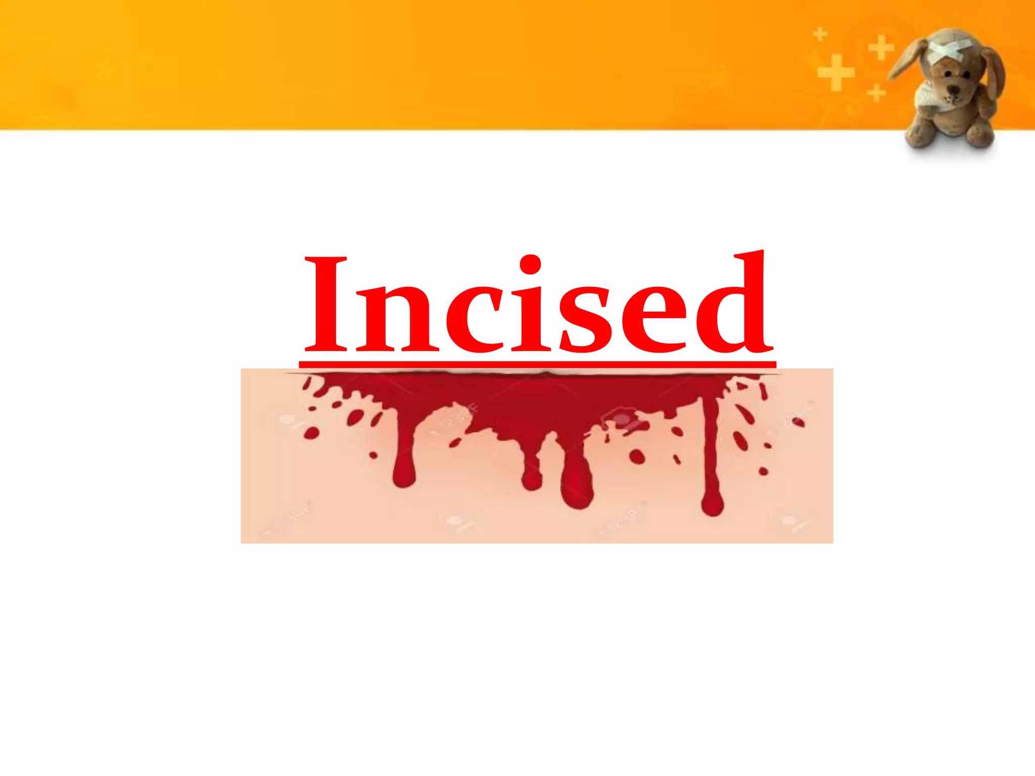 Injury (Forensic science) | PPTX