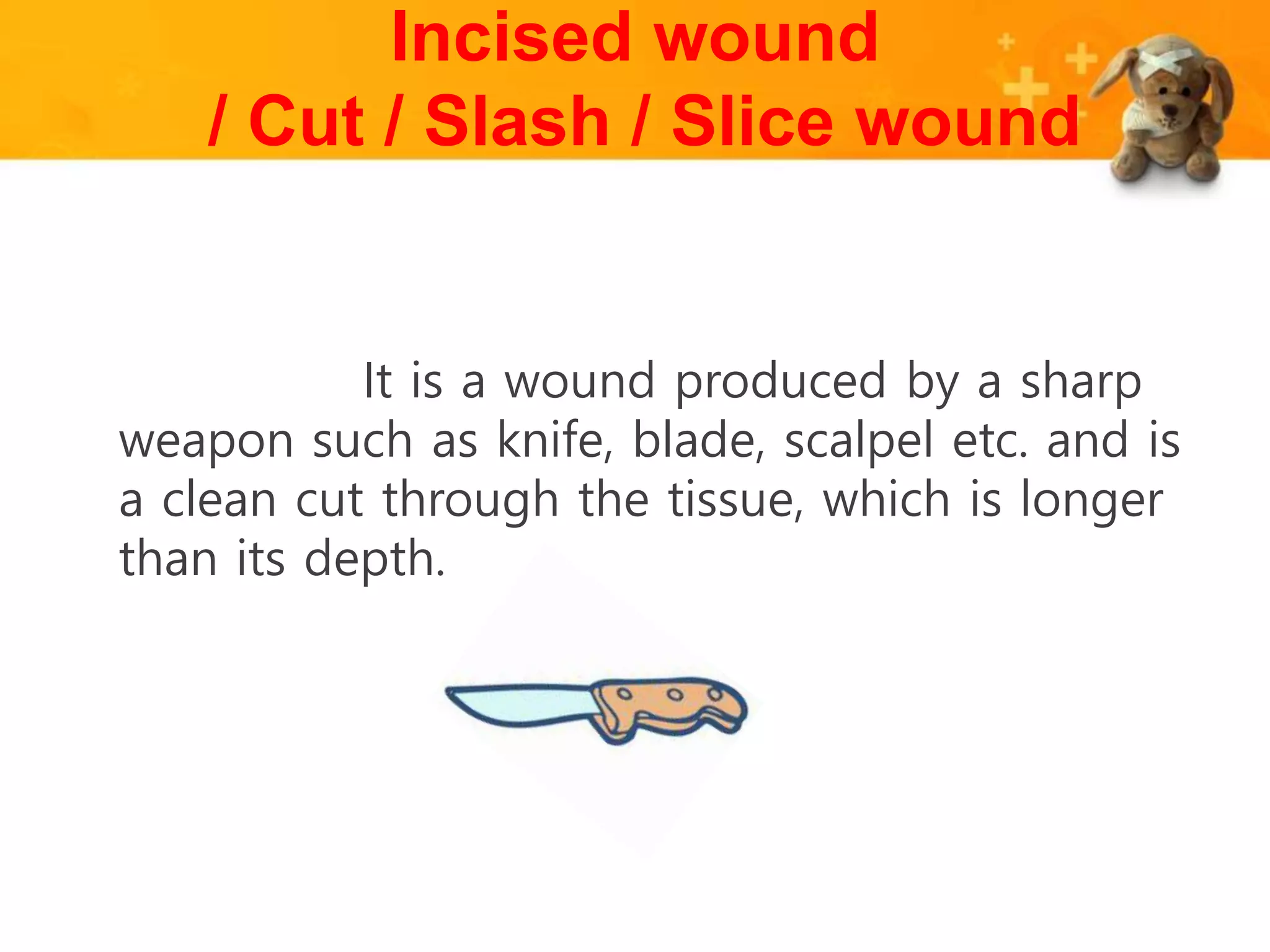 Injury (Forensic science) | PPTX