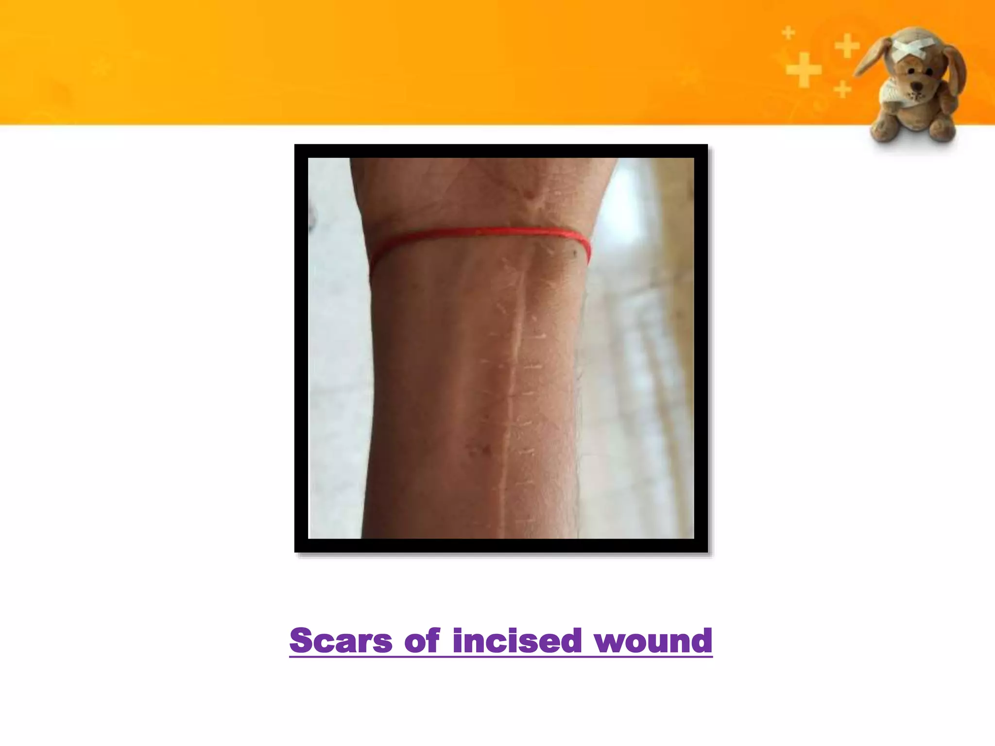 Injury (Forensic science) | PPTX