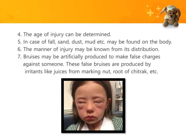 Injury (Forensic science) | PPTX | First Aid | Injuries