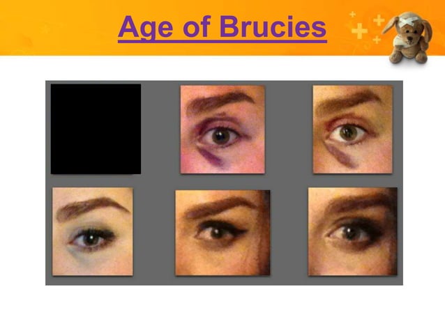 Injury (Forensic science) | PPTX | First Aid | Injuries