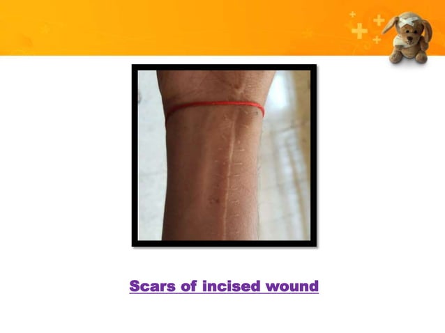 Injury (Forensic science) | PPTX | First Aid | Injuries