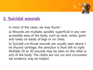 Injury (Forensic science) | PPTX