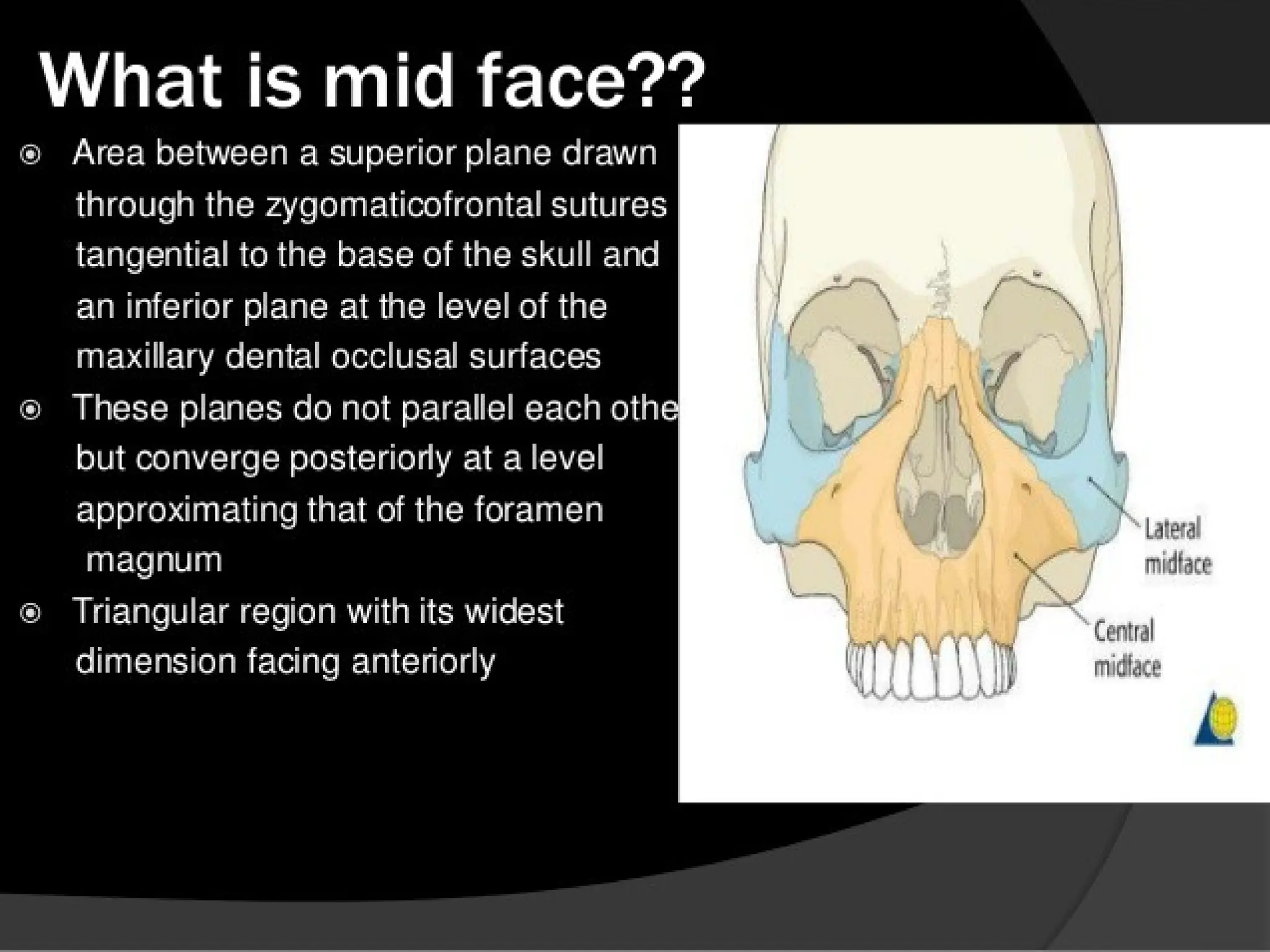 Injury and Fractures Middle Third of Face .pptx