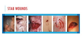 INJURY ASSESSMENT, CLASSIFICATION AND DOCUMENTATION.pdf