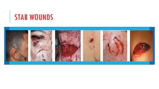 INJURY ASSESSMENT, CLASSIFICATION AND DOCUMENTATION.pptx