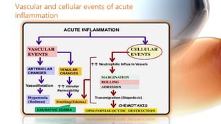 ACUTE INFLAMMATION | PPTX