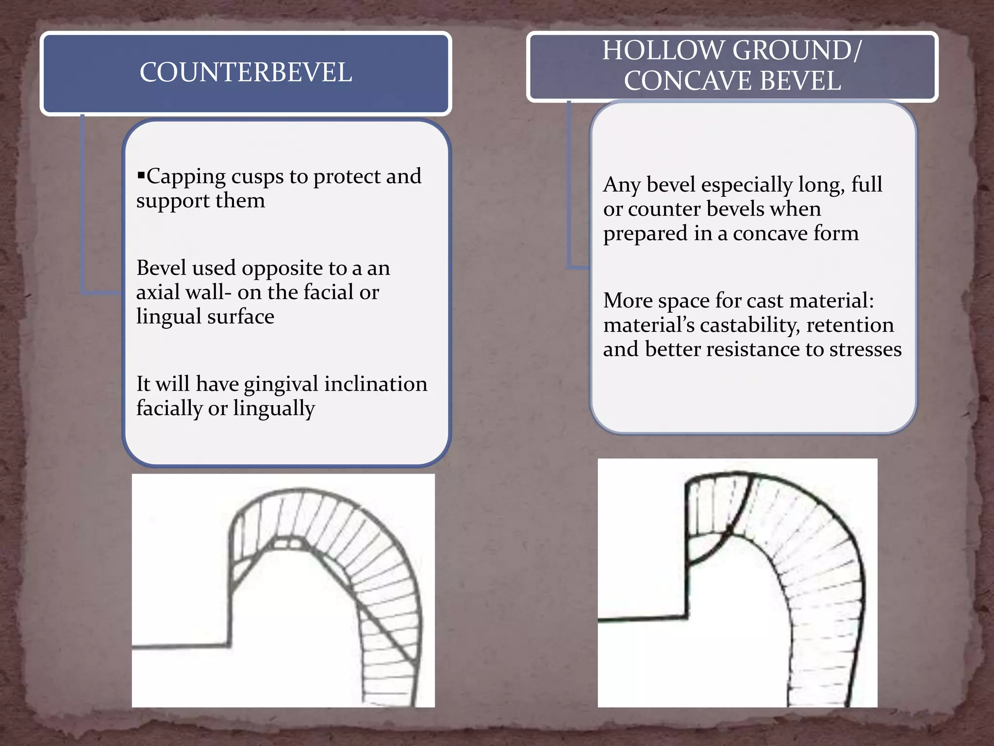 Inlay.pptx | Dental Health | Diseases and Conditions