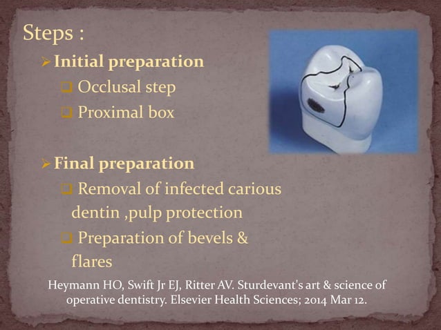 Inlay.pptx | Dental Health | Diseases and Conditions