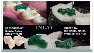 INLAY CAVITY PREPARATION seminaar.pptx