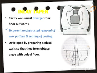 Inlay Nupur important for dental students | PPTX
