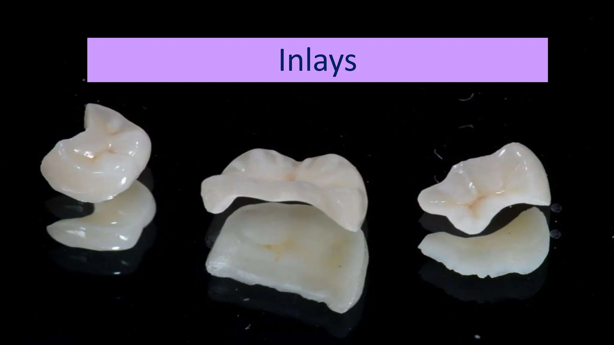 Inlay cavity preparation by direct and indirect method for the ...