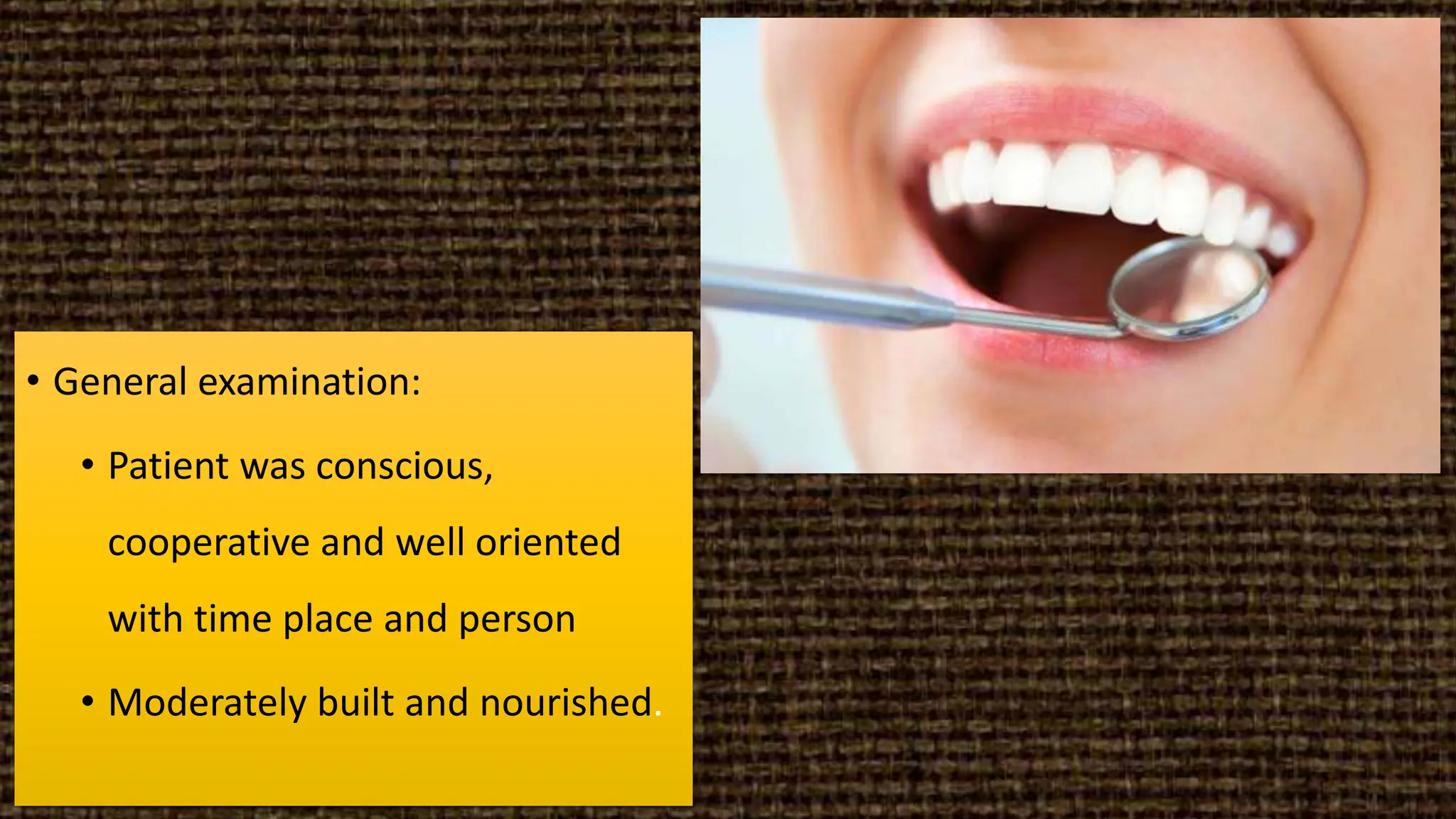 Inlay cavity preparation by direct and indirect method for the ...