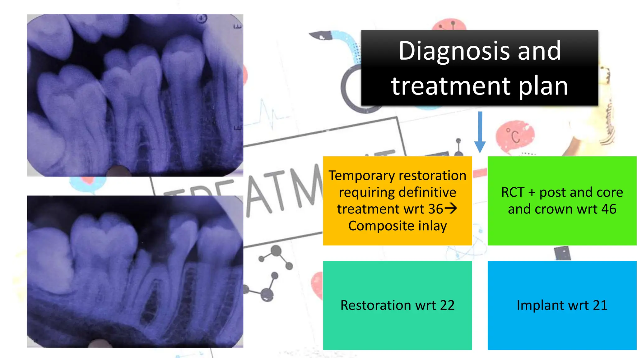 Inlay cavity preparation by direct and indirect method for the ...
