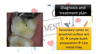 Inlay cavity preparation by direct and indirect method for the ...