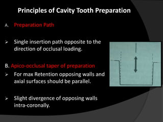 inlays and onlays, classification of inlays and onlays | PPTX