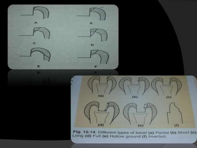 inlays and onlays, classification of inlays and onlays | PPTX | Dental ...