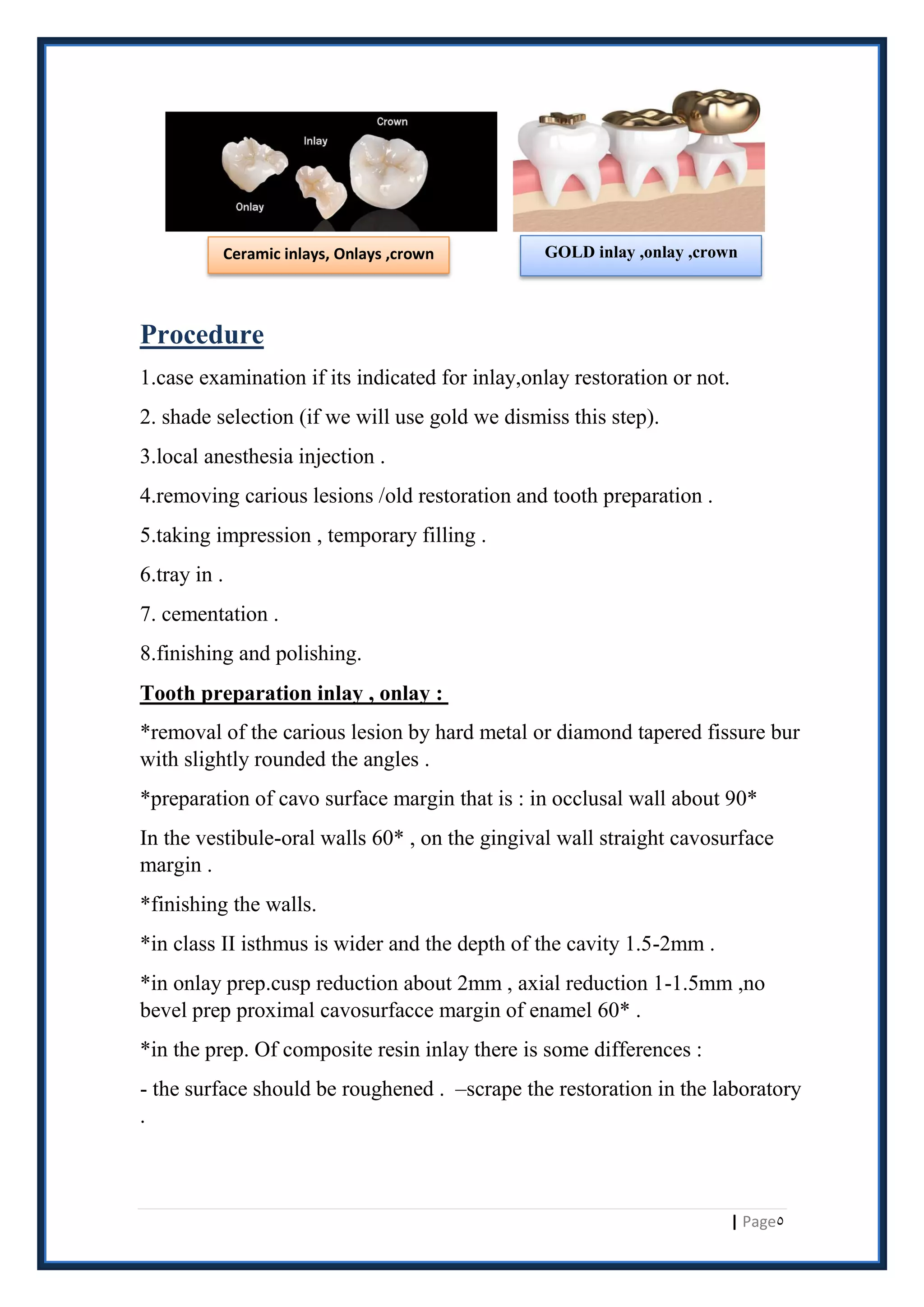 Inlays & onlays (crown and bridge ) | PDF