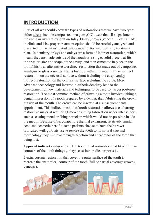 Inlays & onlays (crown and bridge ) | PDF | Dental Health | Diseases ...
