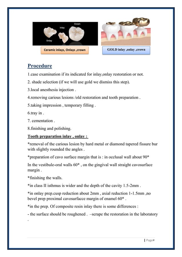 Inlays & onlays (crown and bridge ) | PDF | Dental Health | Diseases ...