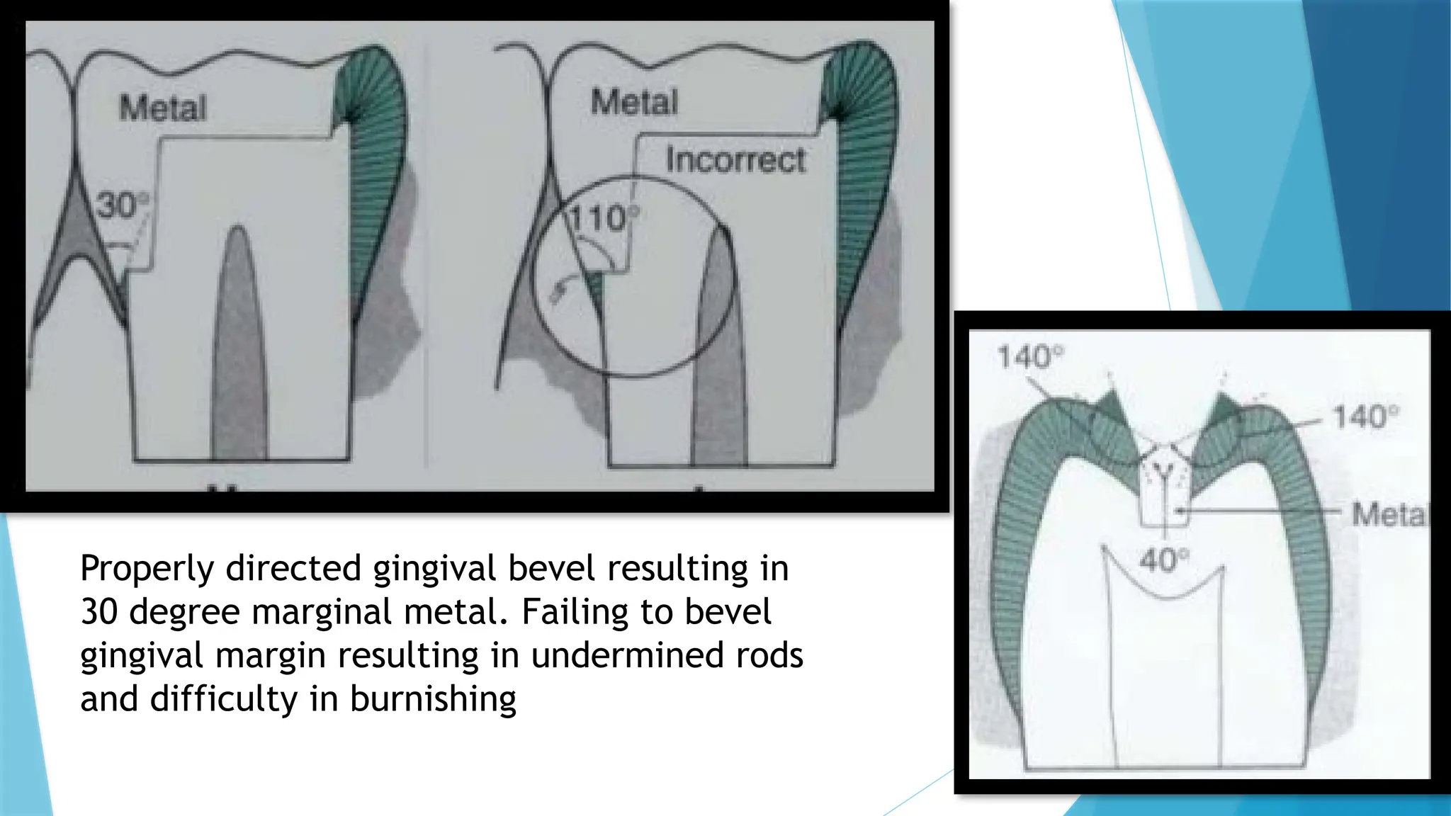 Inlay wax USED IN OPERATIVE DENTISTRY.pptx