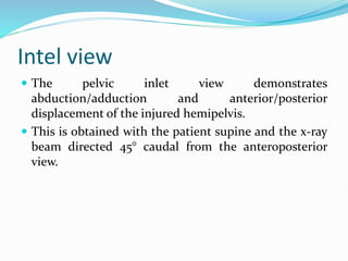 inlet and outlet.pptx | Blood Disorders | Diseases and Conditions