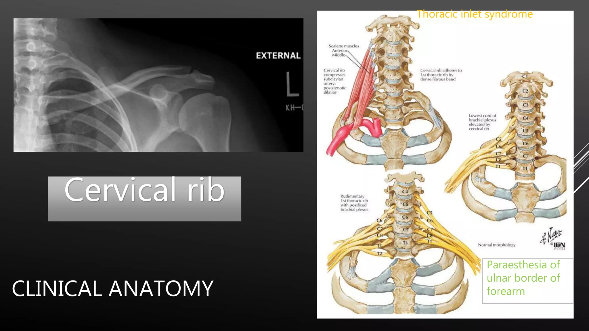Inlet of thorax | PPTX