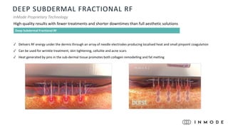 InMode-INMD-Profile-Q12022.ppmt.ppsx