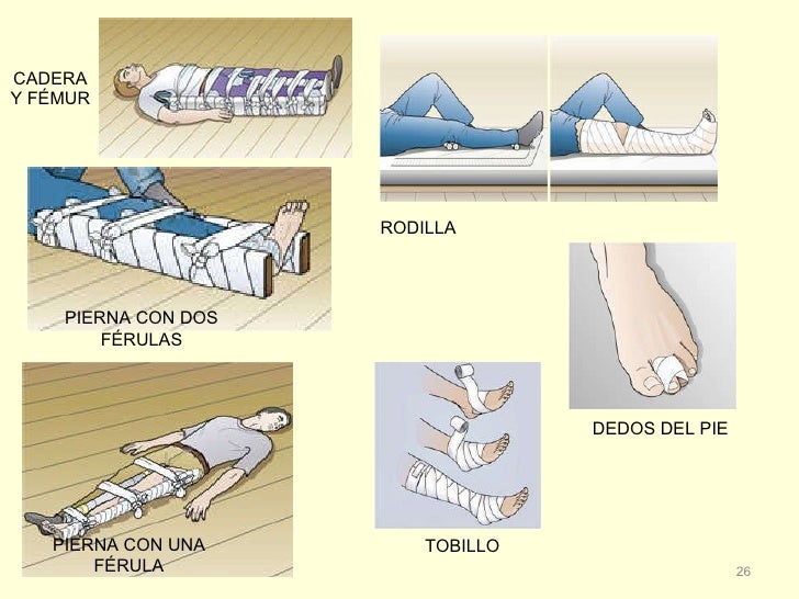 Inmovilizaciones