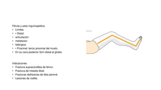 INMOVILIZACIONES BASICAS EN EL AREA DE FRACTURAS | PPTX