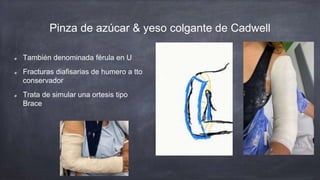 Inmovilizaciones en trauma | PPTX