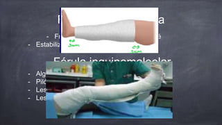 Inmovilizaciones en trauma | PPTX