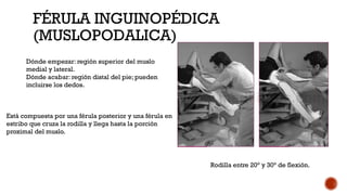 INMOVILIZACION MIEMBRO INFERIOR EN ORTOPEDIA | PPTX